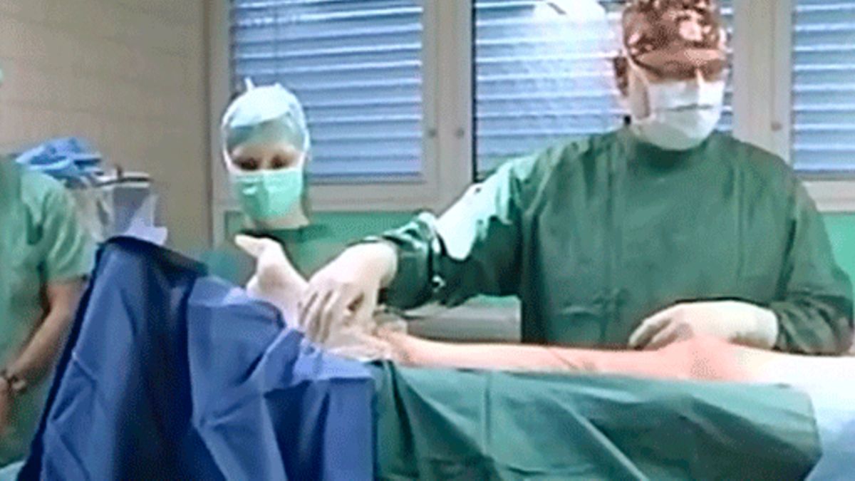 Varizen-Operation mit dem VNUS-Closure™-Verfahren