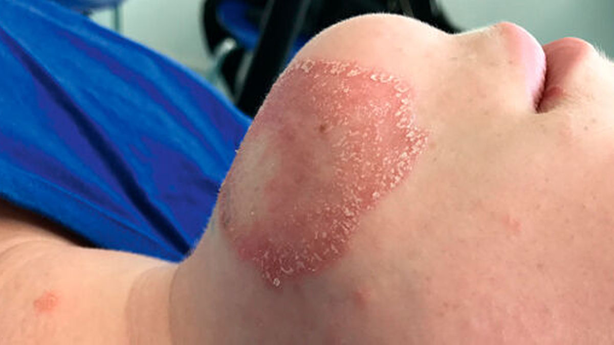 Passende Pilztherapie für Groß und Klein