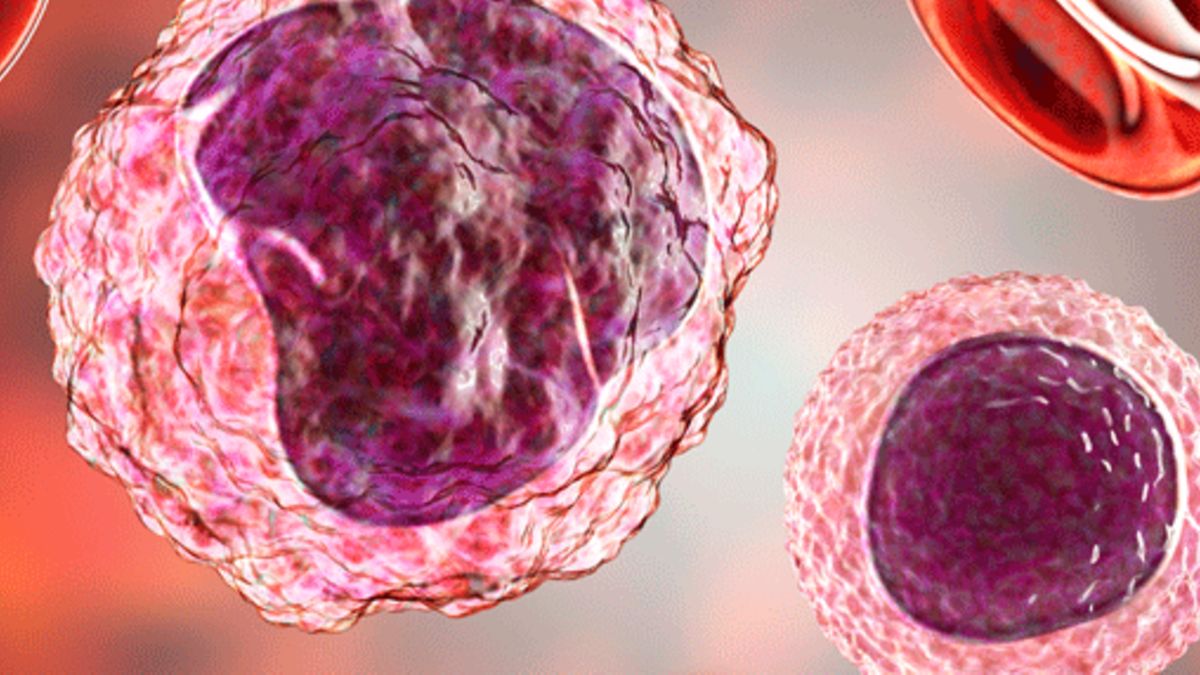 Monozyten sagen Prognose von Lungenfibrose-Patienten voraus