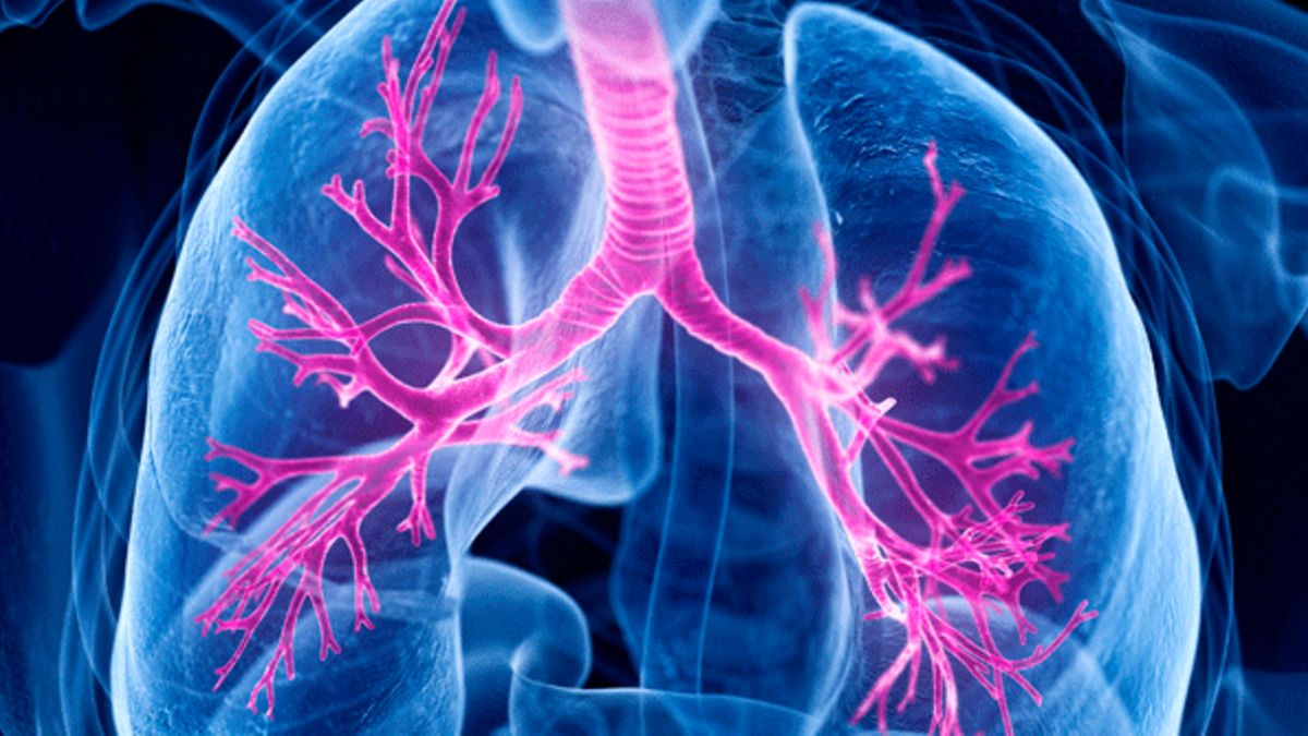 Ambulant erworbene Pneumonie: Kein Fall für Cephalosporine