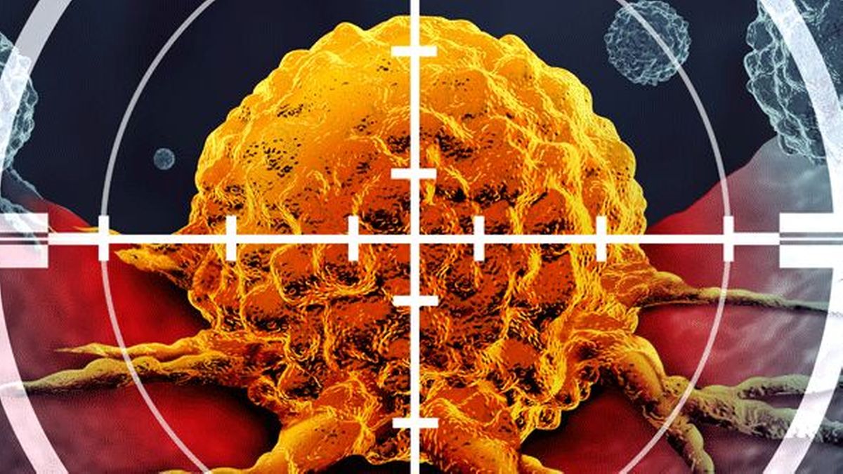 Was Patholog:innen über die Radiosensitivität von Tumoren wissen