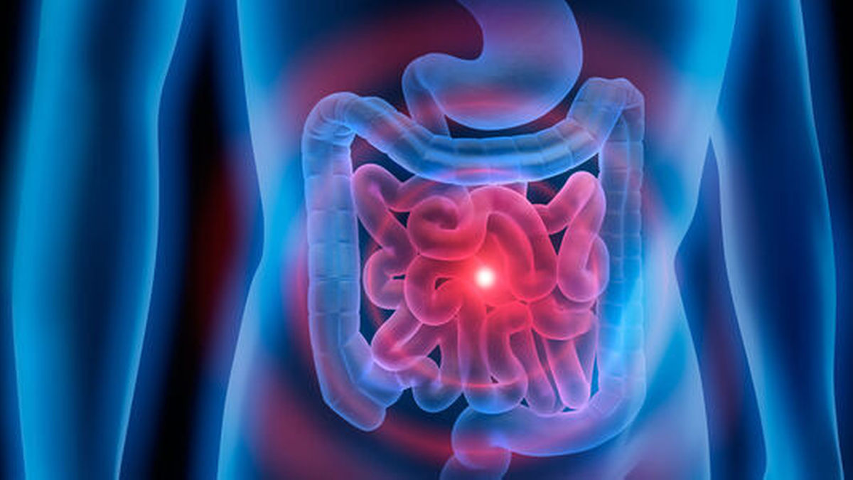 Gastroenterologie (4): Infektion mit Clostridium difficile