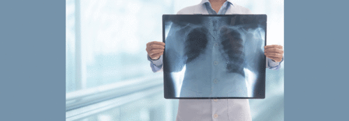 Neue Erstliniendaten für Fulzerasib und Cetuximab