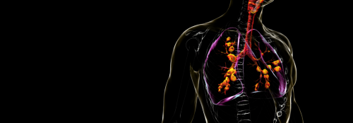 Mehr Trittsicherheit im Umgang mit Bronchiektasen