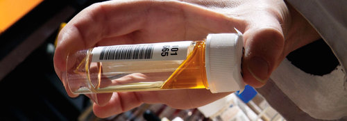 „UACR-Tests sind die beste Methode“