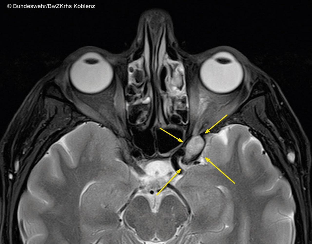 In der Höhle ist für vieles Platz