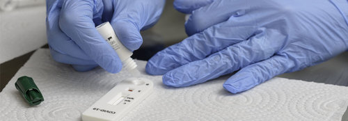 15 Euro pro Corona-Schnelltest