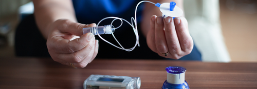 Was es beim DIY Closed Loop in der Praxis zu beachten gibt