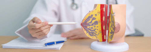 Bessere Diagnostik bei dichtem Brustdrüsengewebe