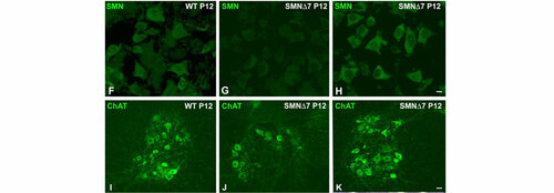 Den Muskelschwund überwinden