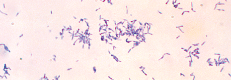 Die neue Diphtherie: Infektionen mit Corynebacterium ulcerans nehmen zu